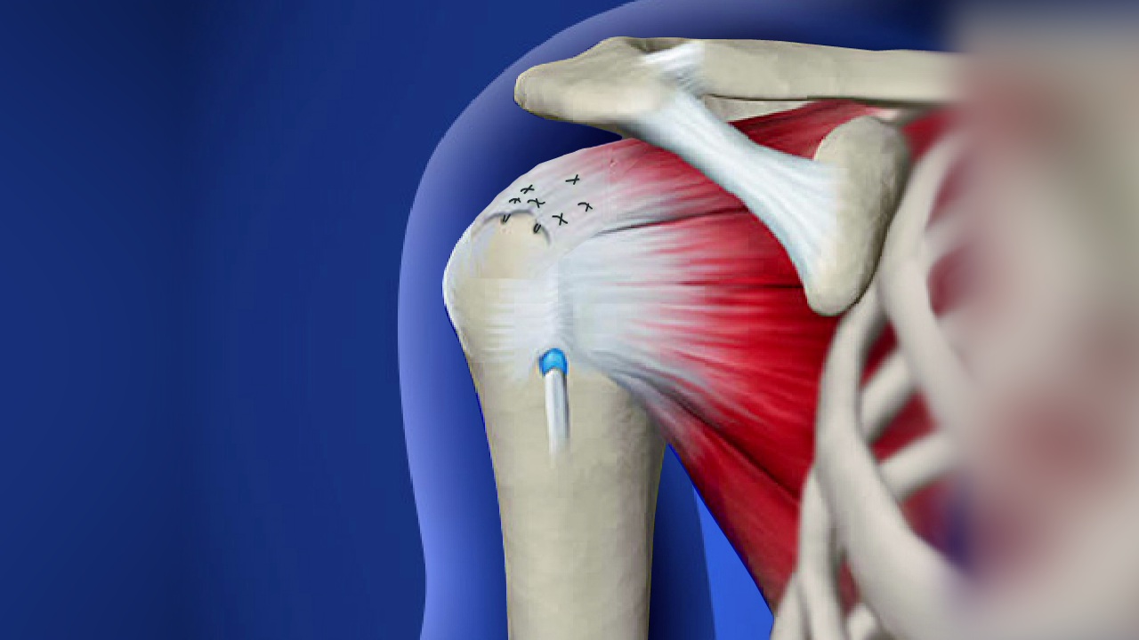 Dr Lokesh H- samvith orthopaedic care